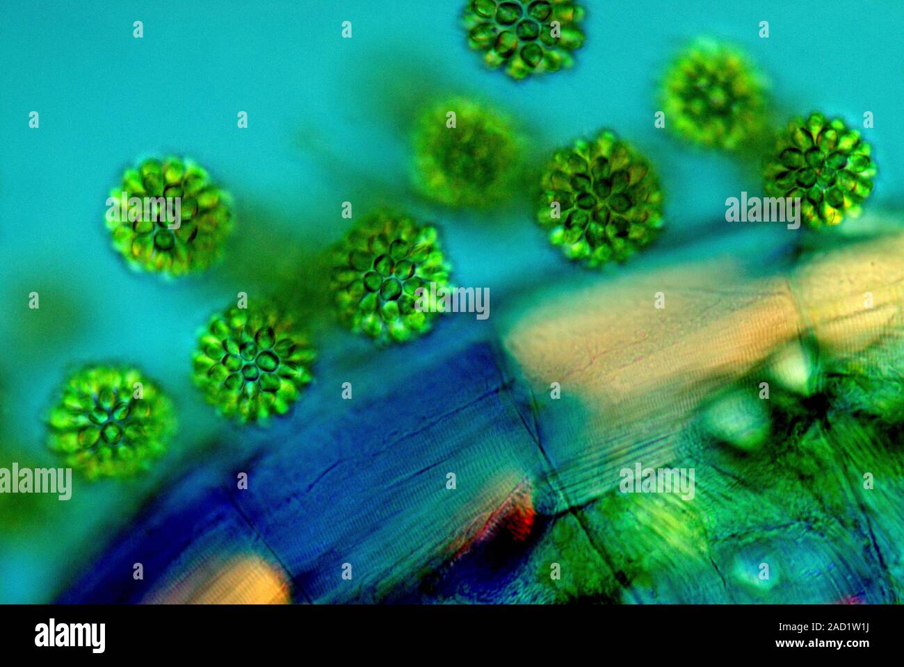 Synurid algae. Polarised light micrograph of Synura uvella algae ...