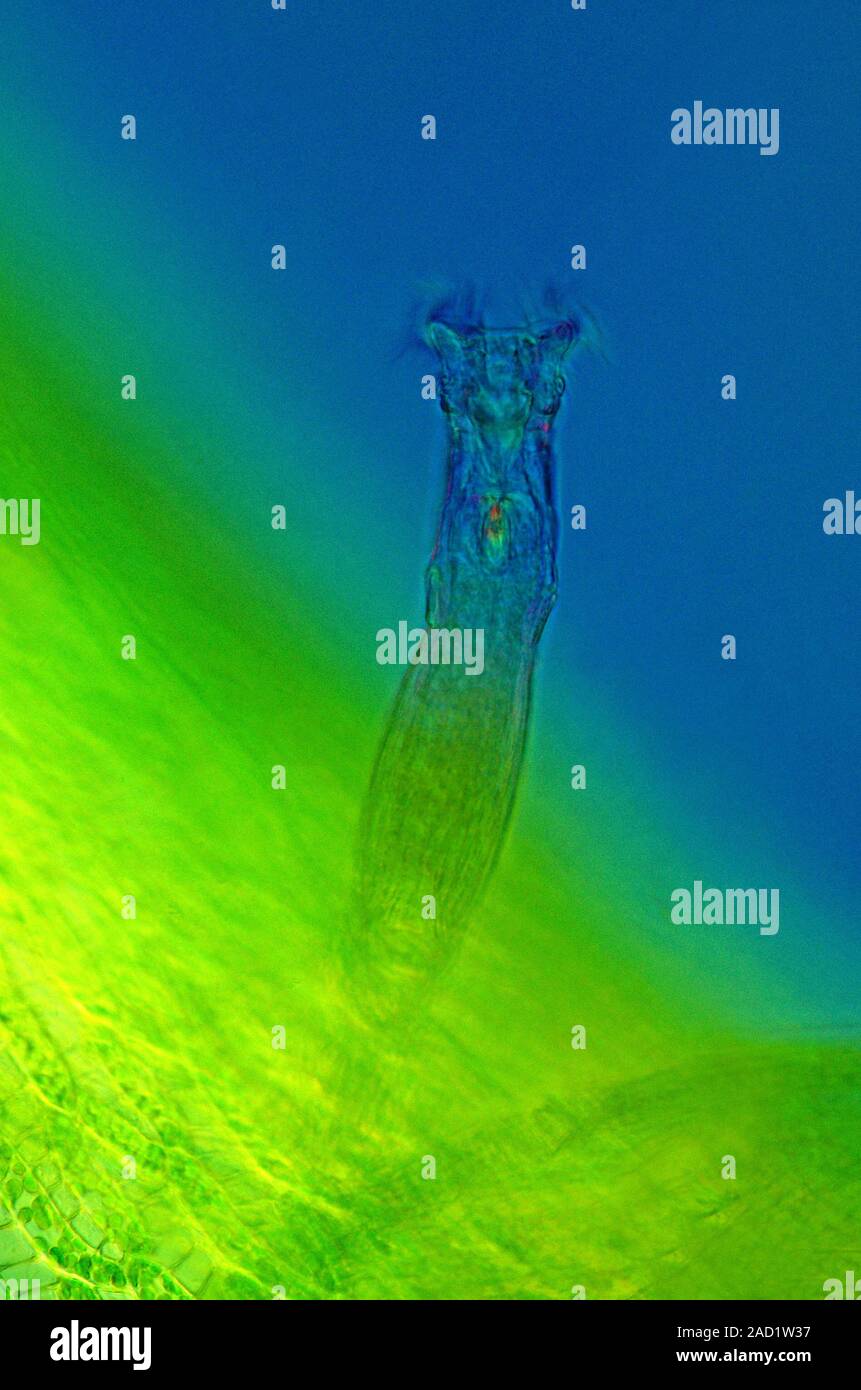 Rotaria rotifer. Polarised light micrograph of a Rotaria sp. rotifer ...