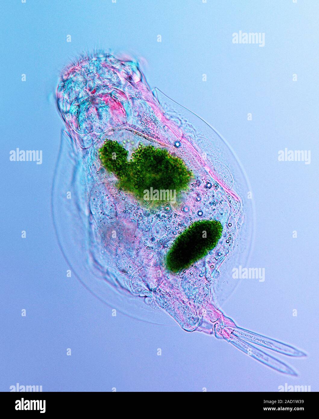 Euchlanis rotifer. Polarised light micrograph of a Euchlanis sp ...