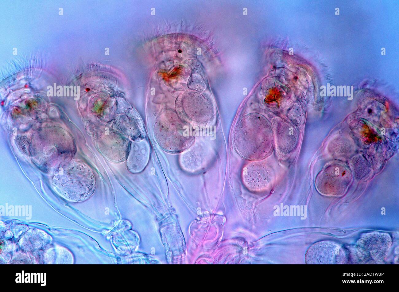 Conochilus rotifers. Polarised light micrograph of Conochilus sp ...