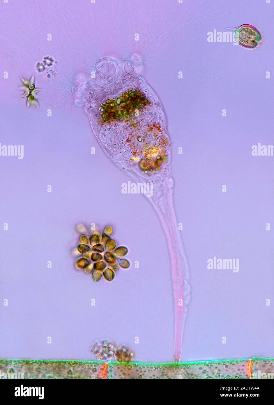 Rotifer, algae and protists. Polarised light micrograph of a Collotheca ...