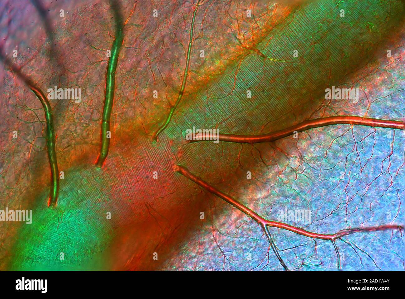 Insect respiratory system. Polarised light micrograph of a trachea ...