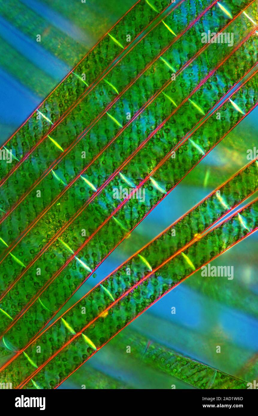 Spirogyra algae. Polarised light micrograph of Spirogyra sp. algae ...