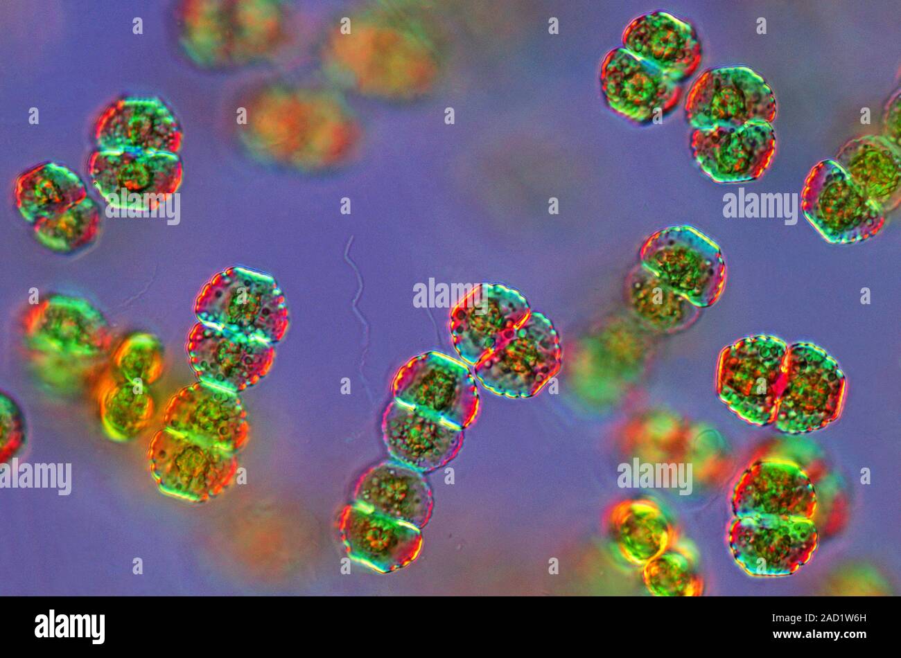 Cosmarium desmids. Polarised light micrograph of Cosmarium sp. desmid ...