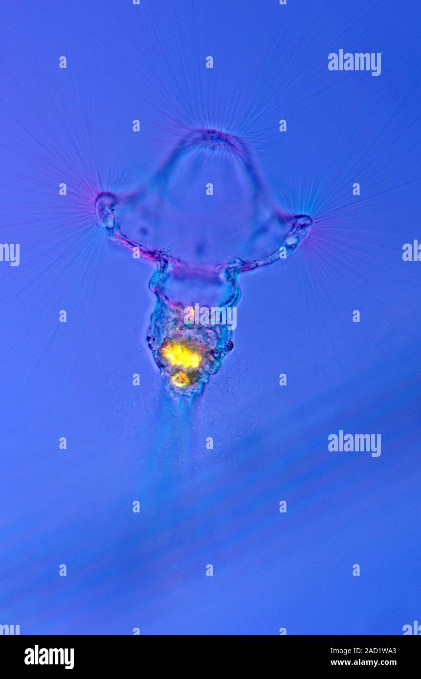 Collotheca rotifer. Polarised light micrograph of a Collotheca sp ...