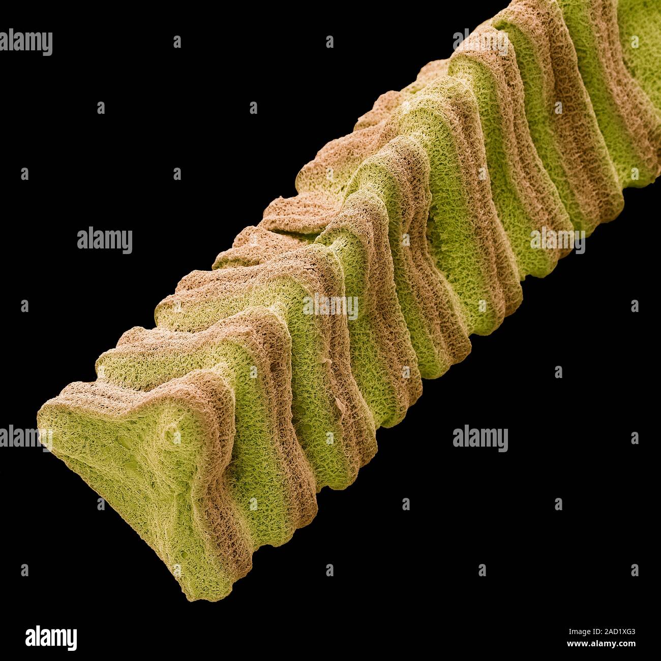Desmidium desmid. Scanning electron micrograph (SEM) of a Desmidium ...