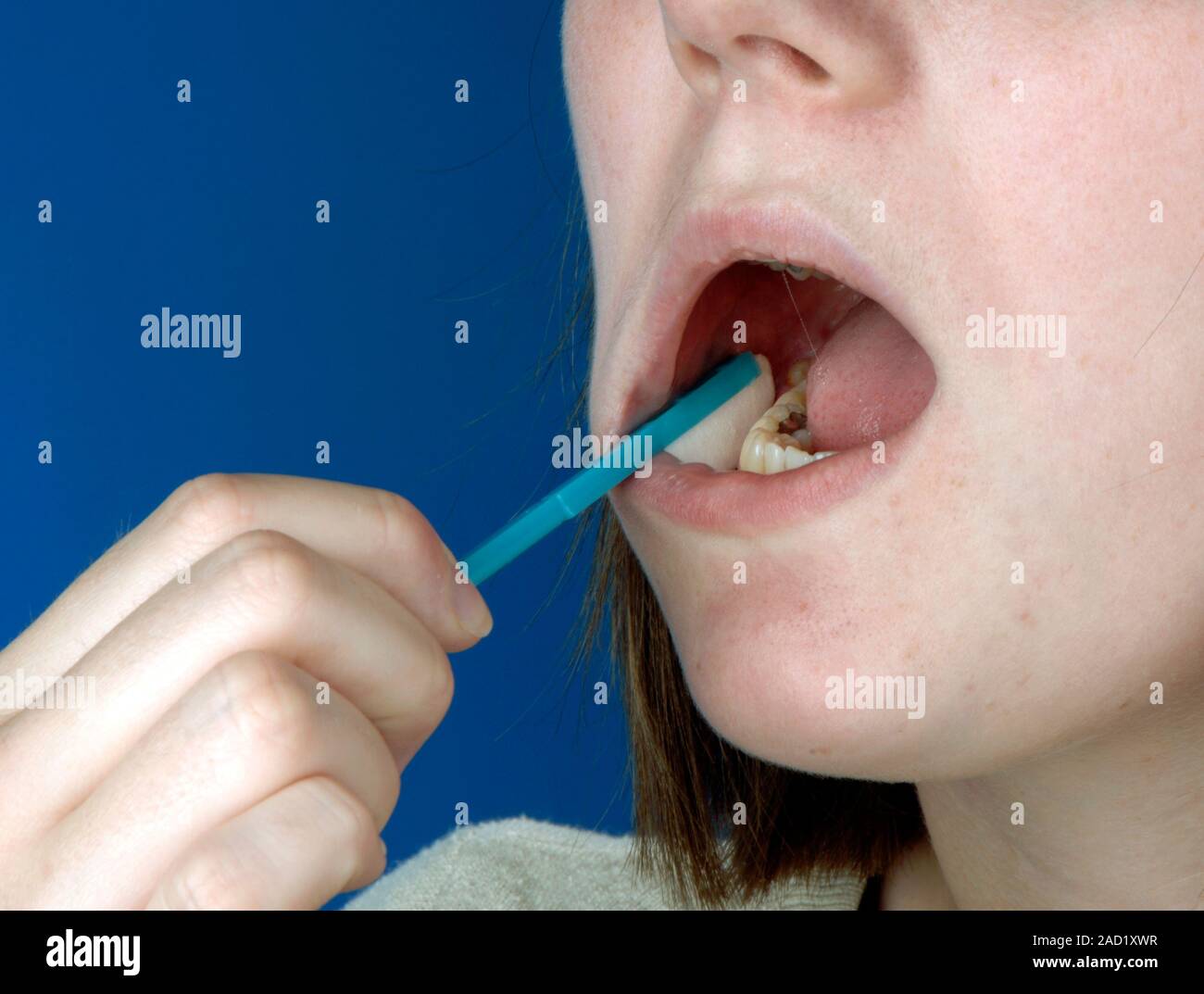 Oral specimen collection device. Close-up of a woman using an oral ...