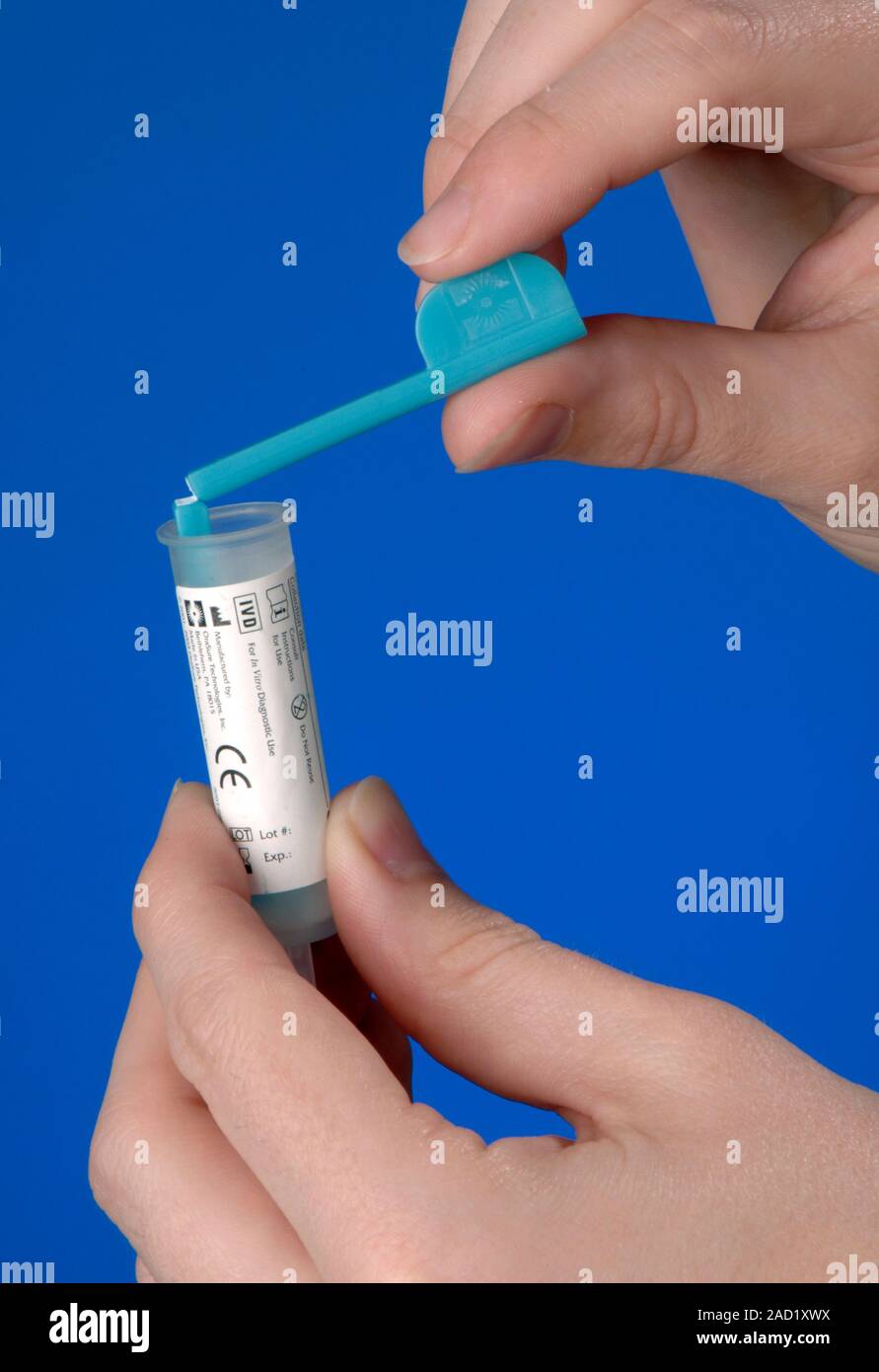 Oral specimen collection device. Close-up of the handle of an oral ...