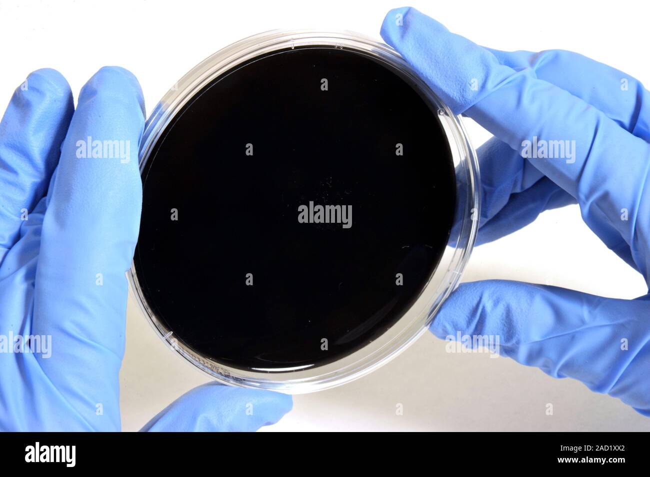 Buffered charcoal yeast extract agar. Close-up of a petri dish ...