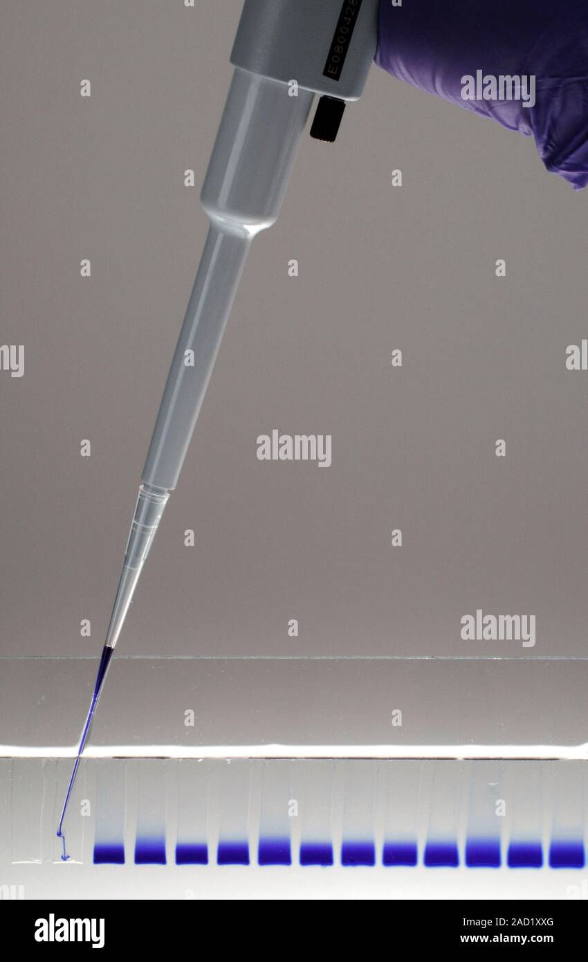 Gel electrophoresis. Close-up of a pipette being used to load samples onto an agarose gel where ...