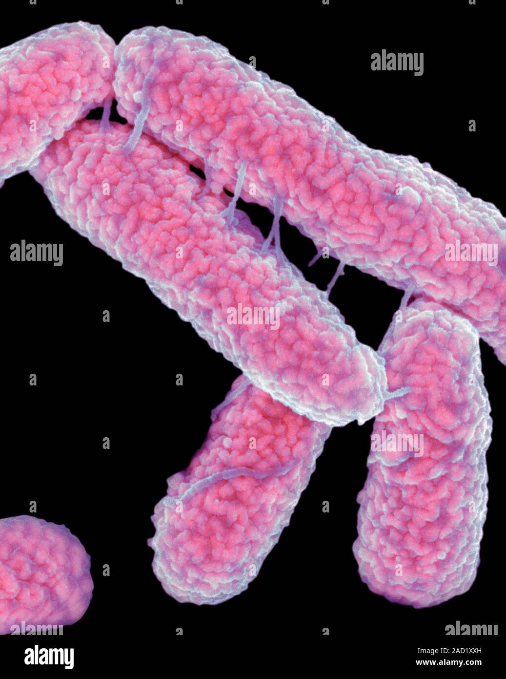 Coloured scanning electron micrograph (SEM) of Escherichia coli ...