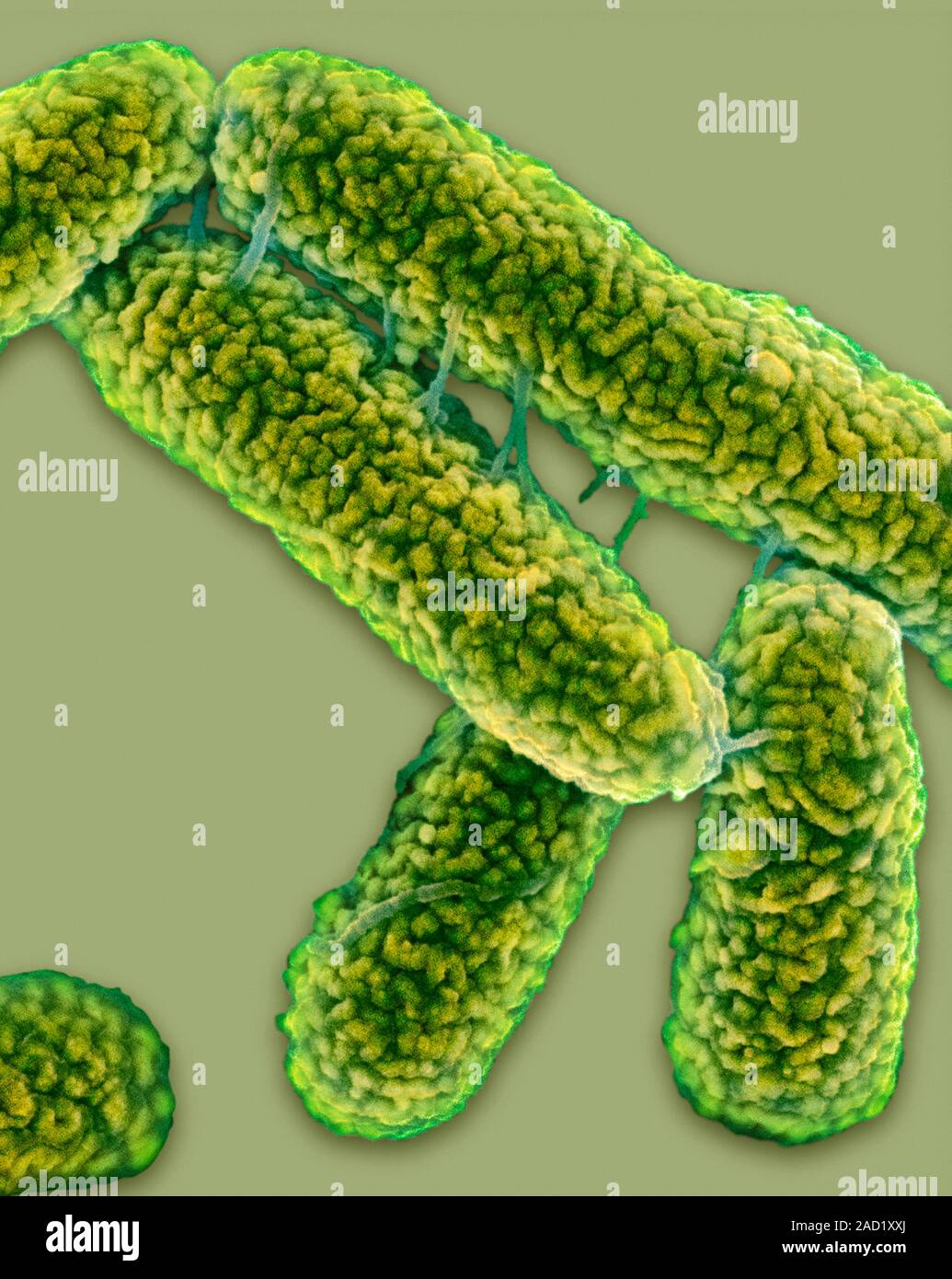 Coloured scanning electron micrograph (SEM) of Escherichia coli ...
