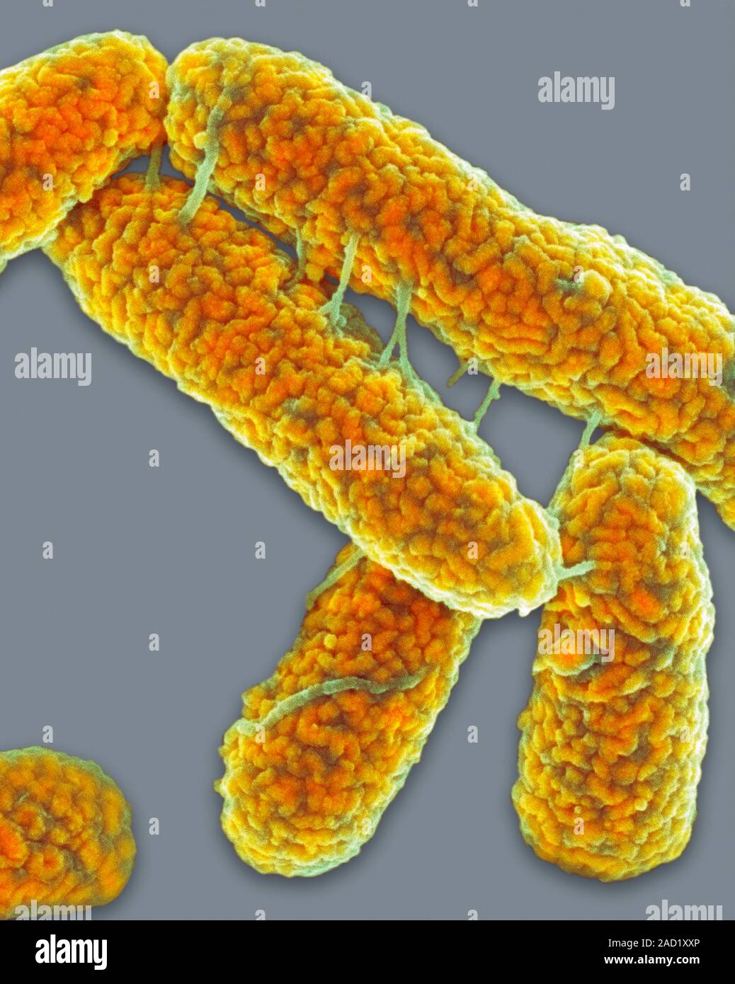 Coloured scanning electron micrograph (SEM) of Escherichia coli ...