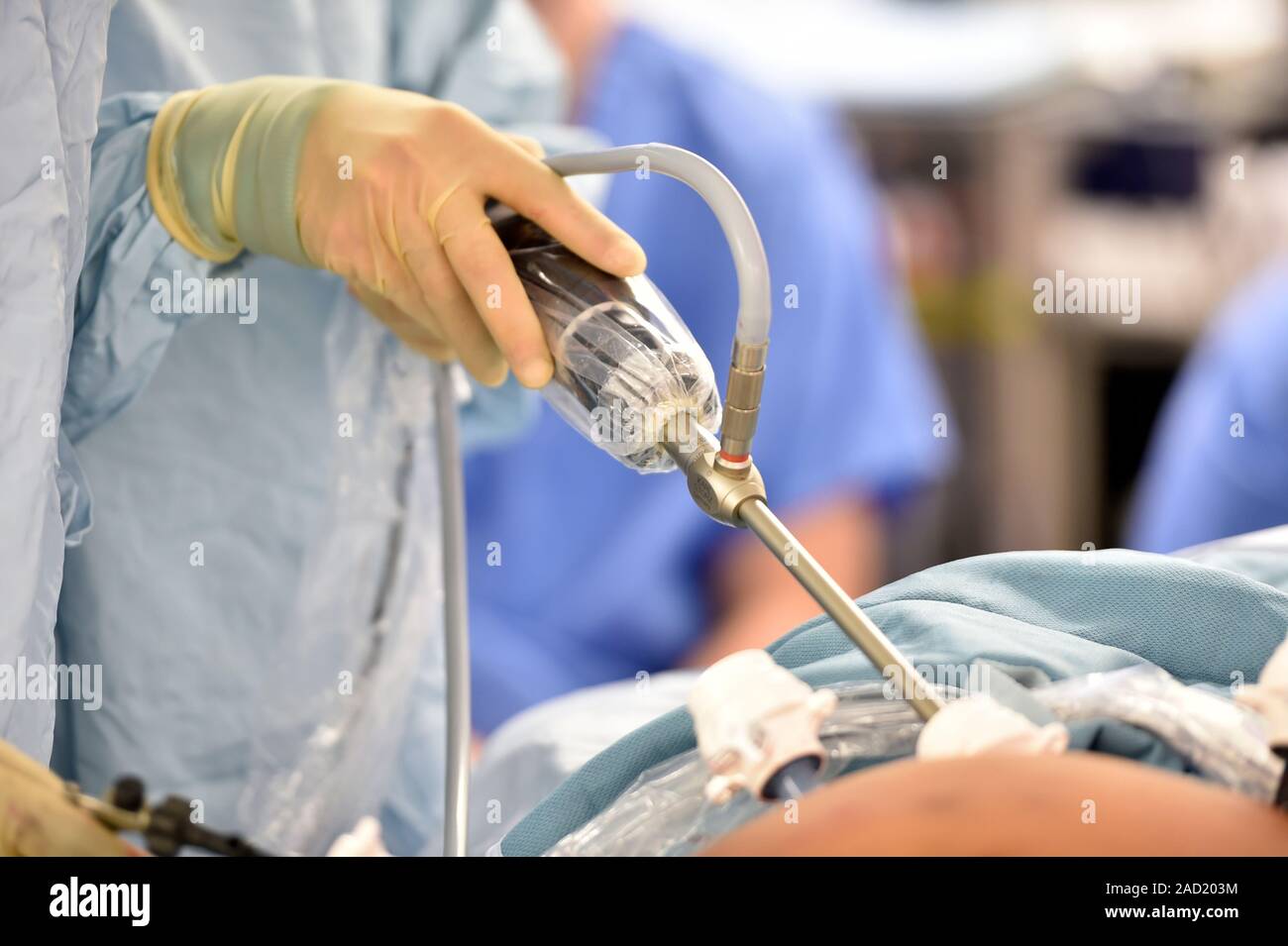 Gastric bypass surgery. Surgeons using endoscopic equipment during ...