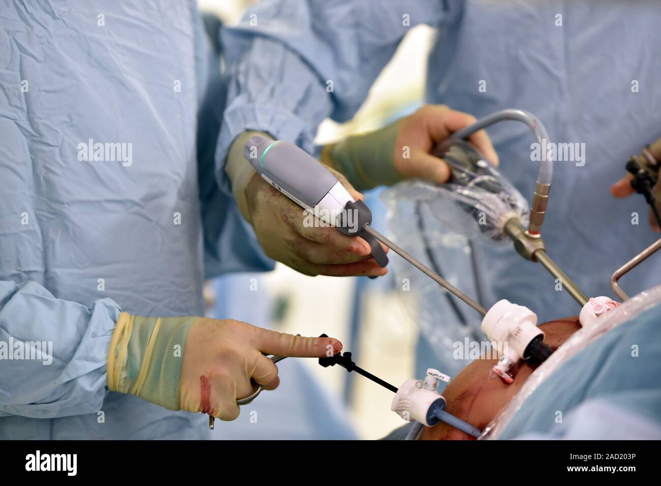 Gastric bypass surgery. Surgeon using endoscopic equipment during ...