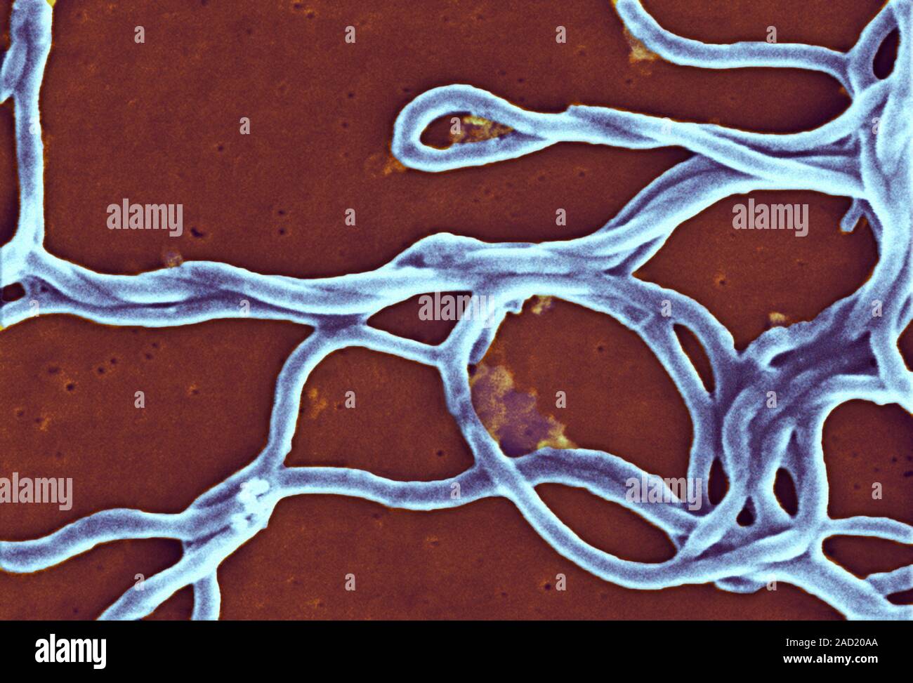 Borrelia burgdorferi bacteria. Coloured scanning electron micrograph ...