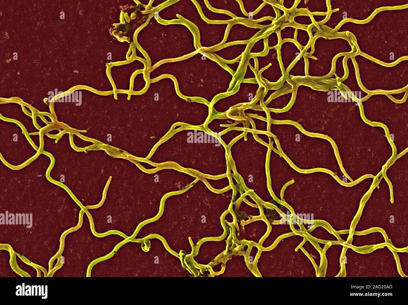 Borrelia burgdorferi bacteria. Coloured scanning electron micrograph ...