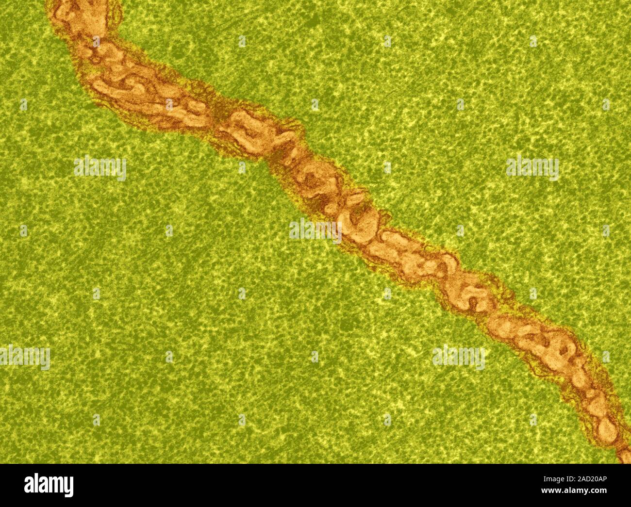 Plant cell dividing. Transmission electron micrograph (TEM) of a ...