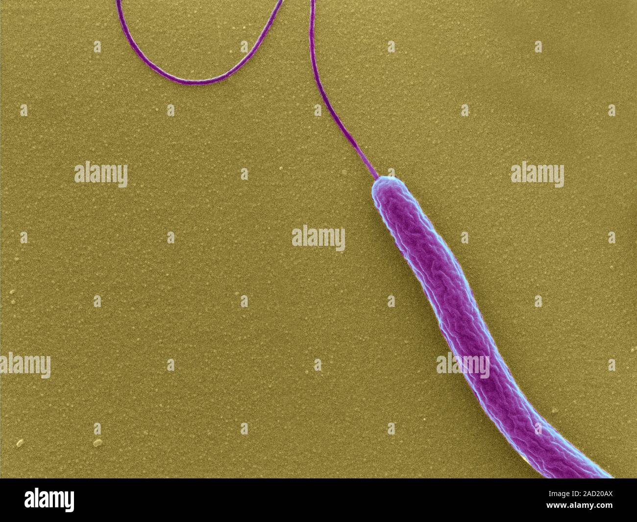 Cholera bacterium. Coloured scanning electron micrograph (SEM) of a ...