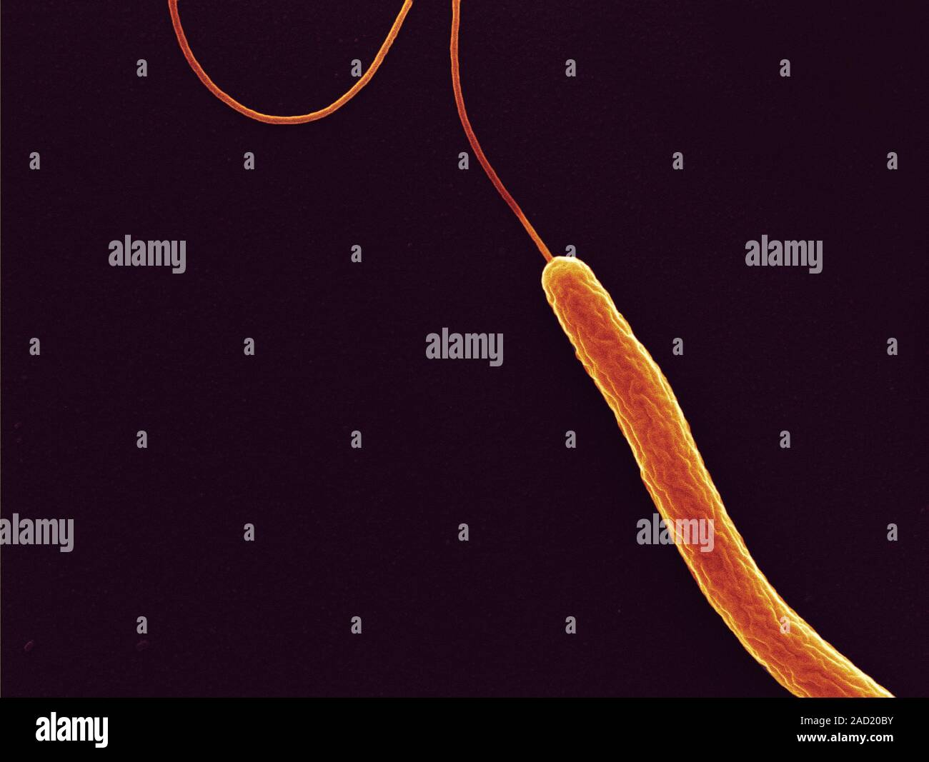 Cholera bacterium. Coloured scanning electron micrograph (SEM) of a ...