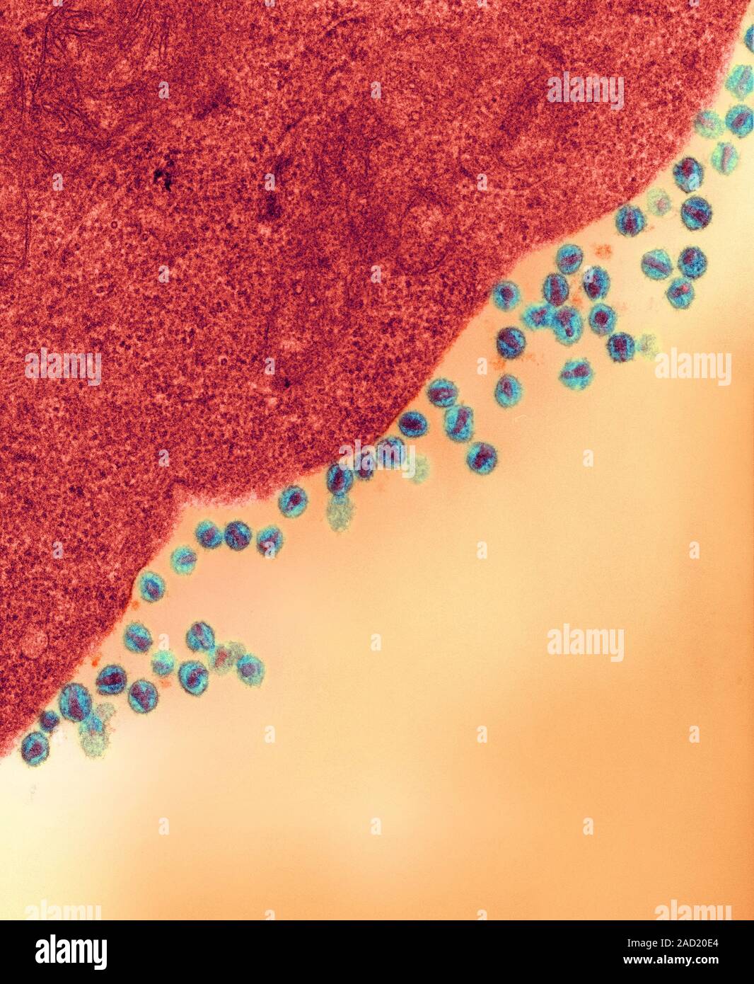 HIV viruses infecting a cell. Transmission electron micrograph (TEM) of ...
