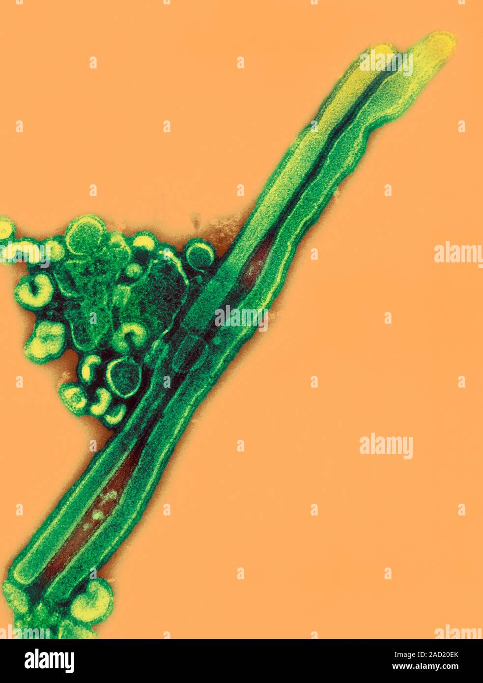Flu virus particles. Transmission electron micrograph (TEM) of a ...