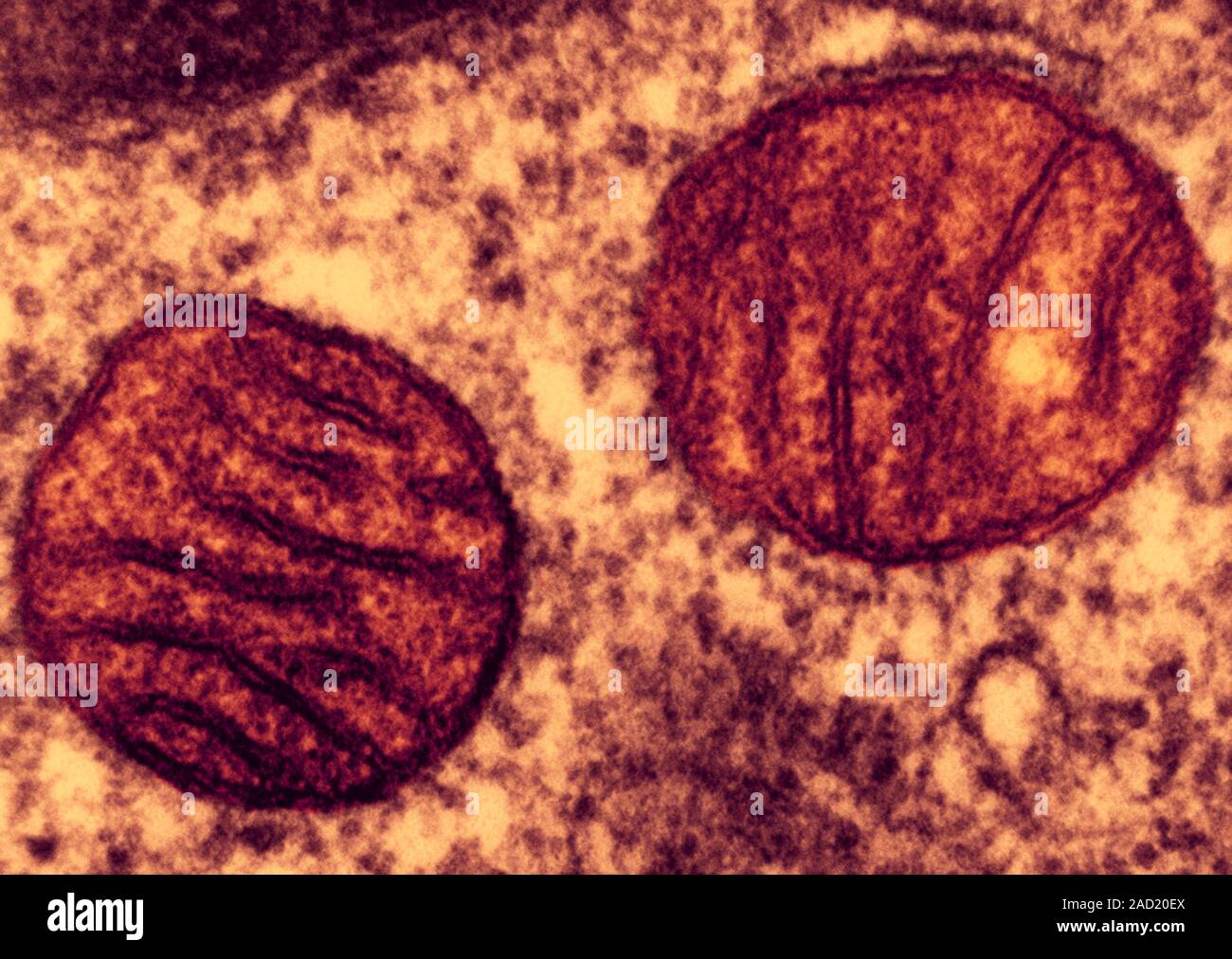 Lung mitochondria. Transmission electron micrograph (TEM) of a section ...