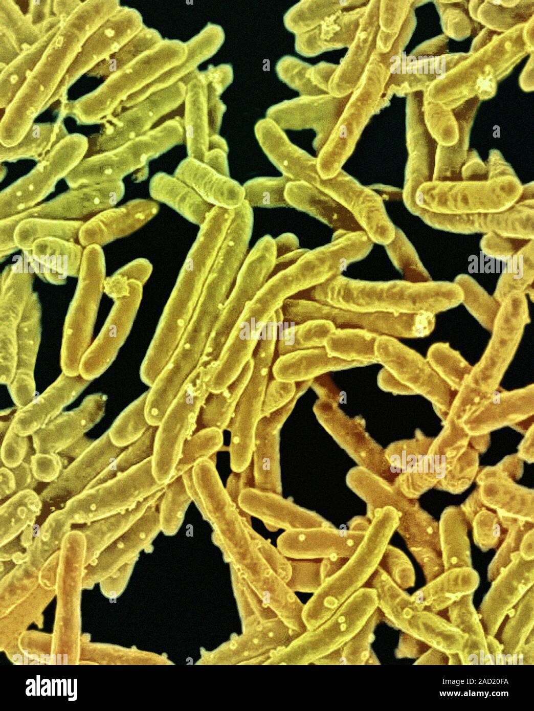 Tuberculosis bacteria. Coloured scanning electron micrograph (SEM) of ... Tuberculosis bacteria. Coloured scanning electron micrograph (SEM) of ...