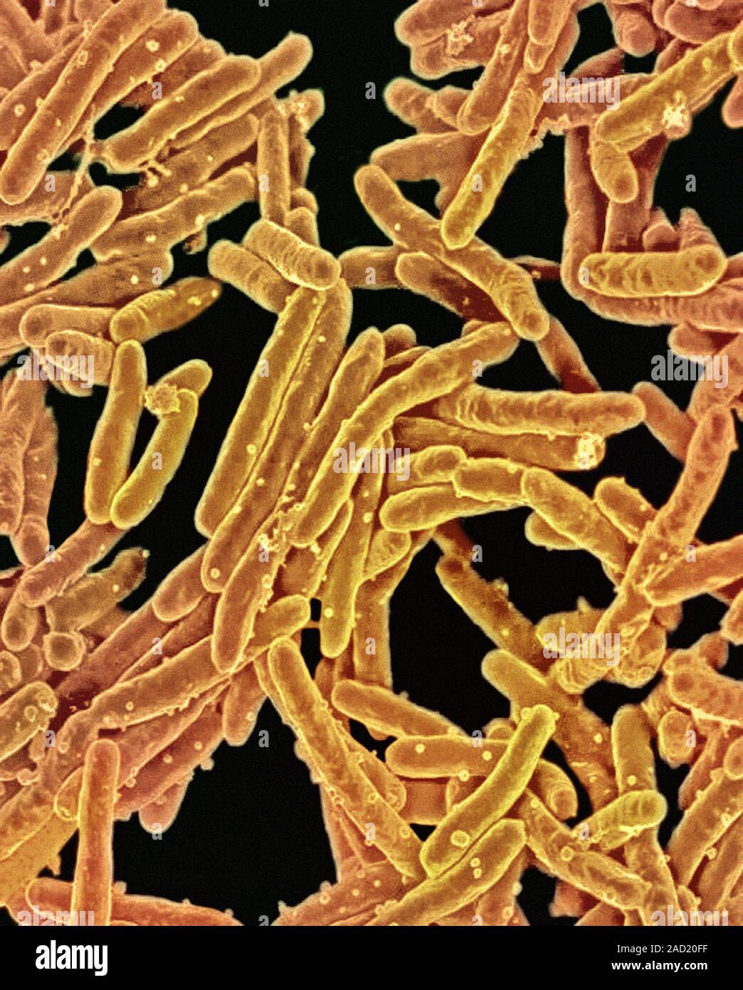 Tuberculosis bacteria. Coloured scanning electron micrograph (SEM) of Mycobacterium tuberculosis ...