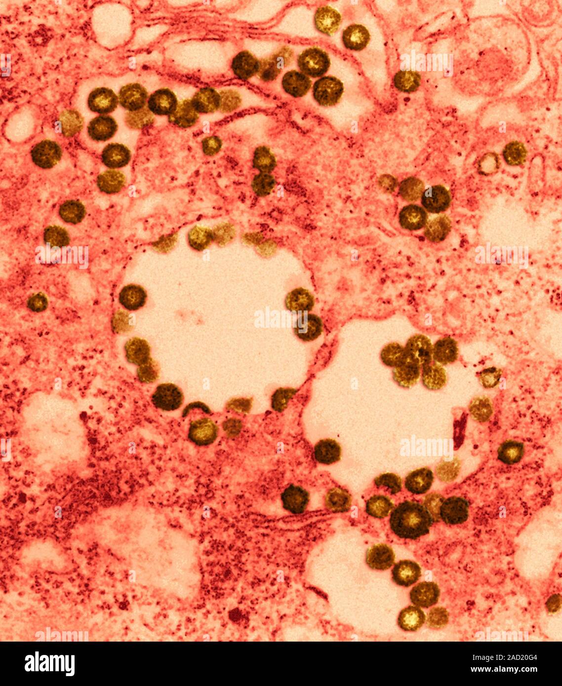 Rift Valley fever virus. Coloured transmission electron micrograph (TEM ...