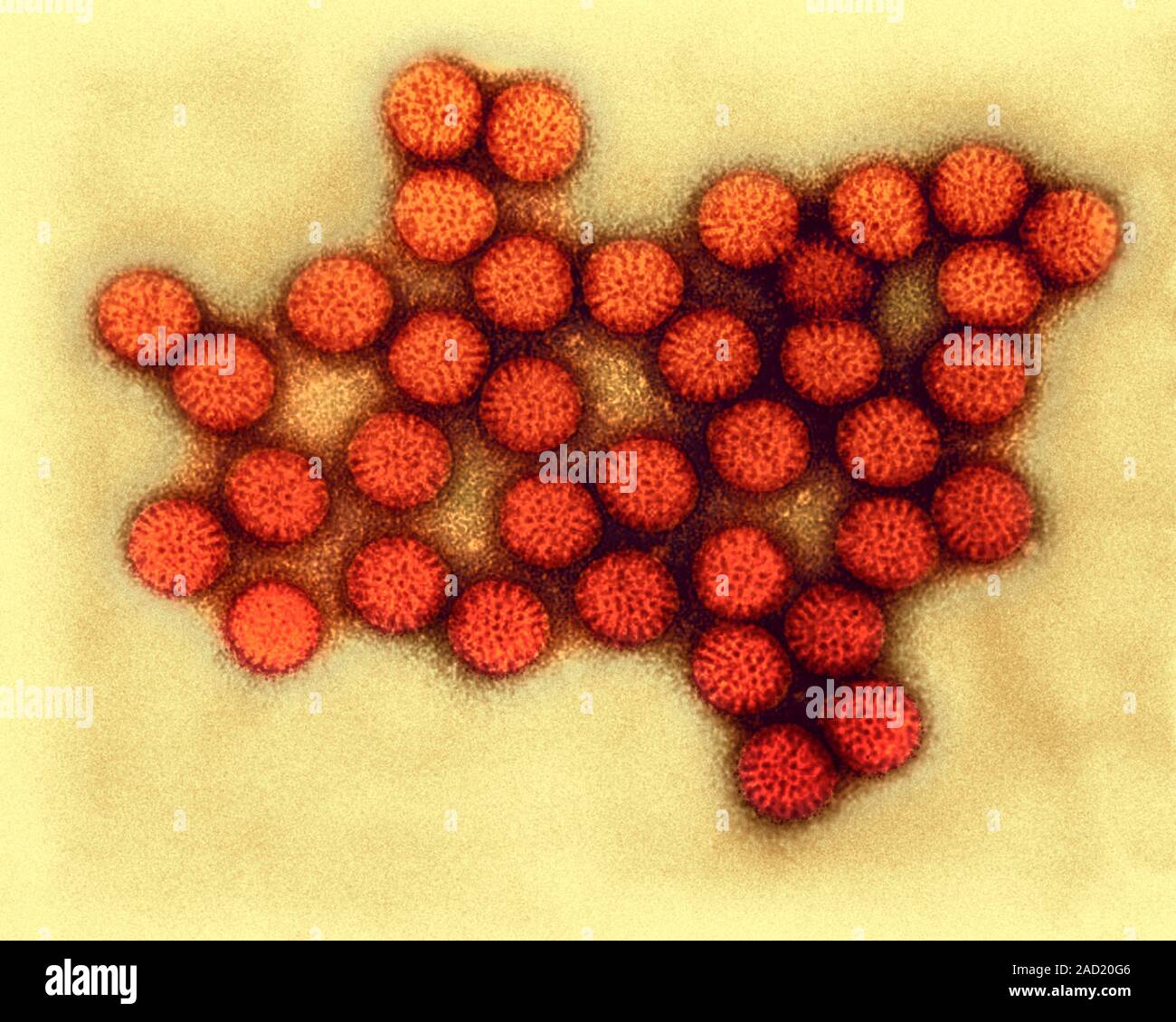 Rotavirus particles. Coloured transmission electron micrograph (TEM) of ...