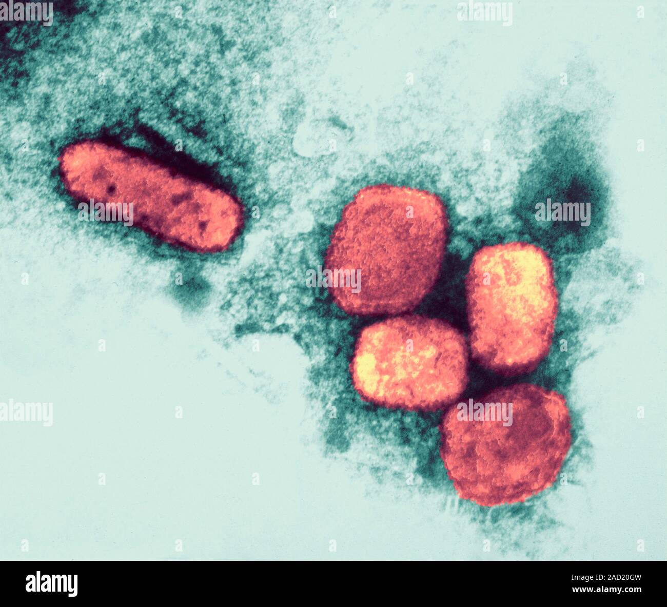 Smallpox virus particles. Coloured transmission electron micrograph ...