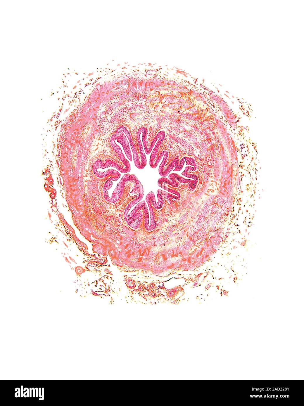 Illustration of the Ureter. This Transverse section illustration is ...