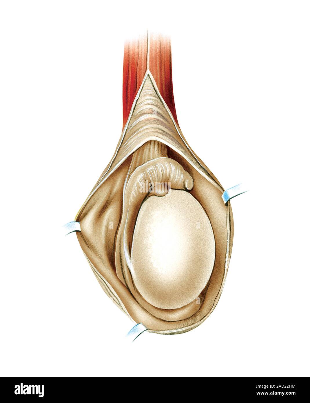 Illustration of the Male Genital System, testis, Epididymis. This ...