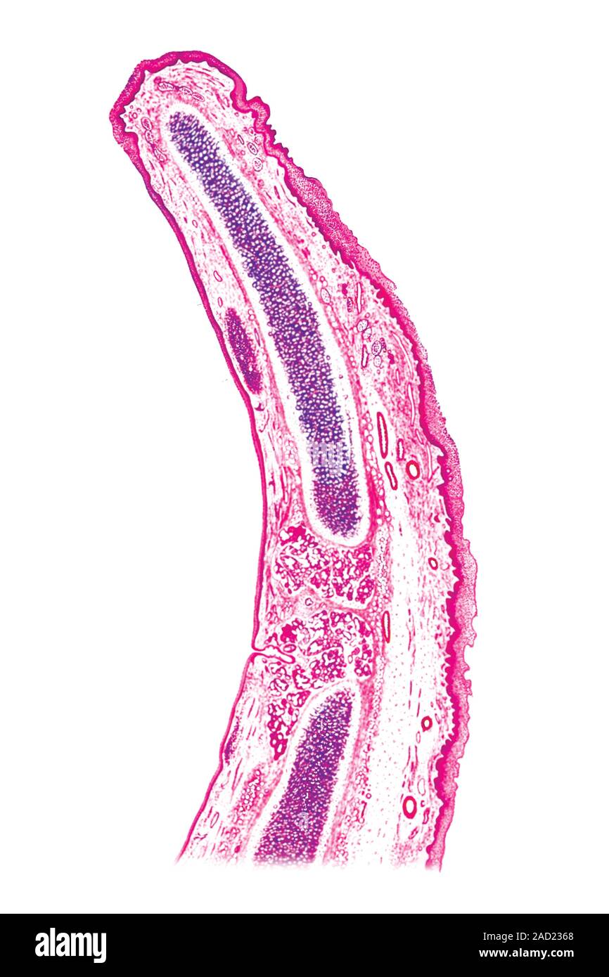 Epiglottis Histology Death Related To Epiglottitis | Forensic Science,