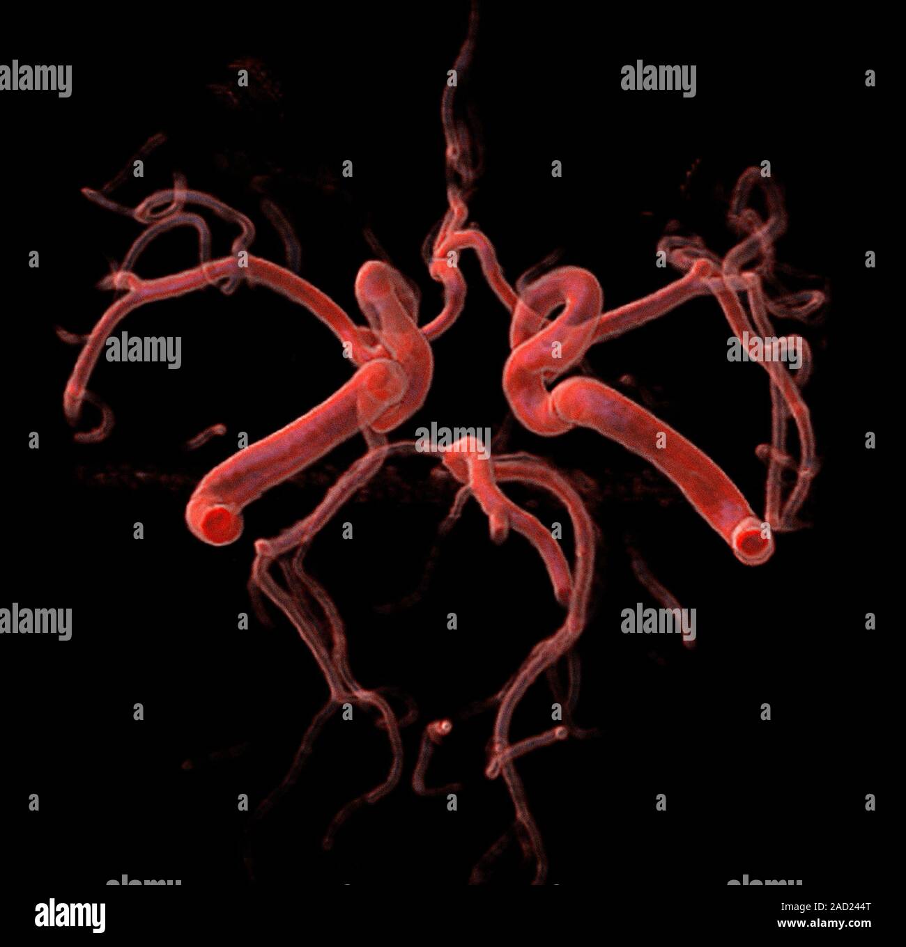 Brain arteries, magnetic resonance angiography (MRA). Cerebral arteries ...