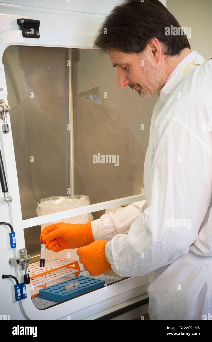 Blood sample analysis. Laboratory researcher handling a blood sample in ...