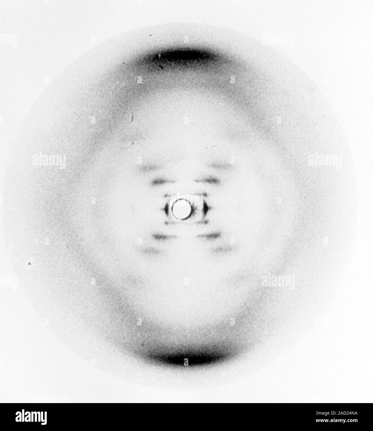 DNA discovery, 1952. X-ray diffraction photograph of DNA ...
