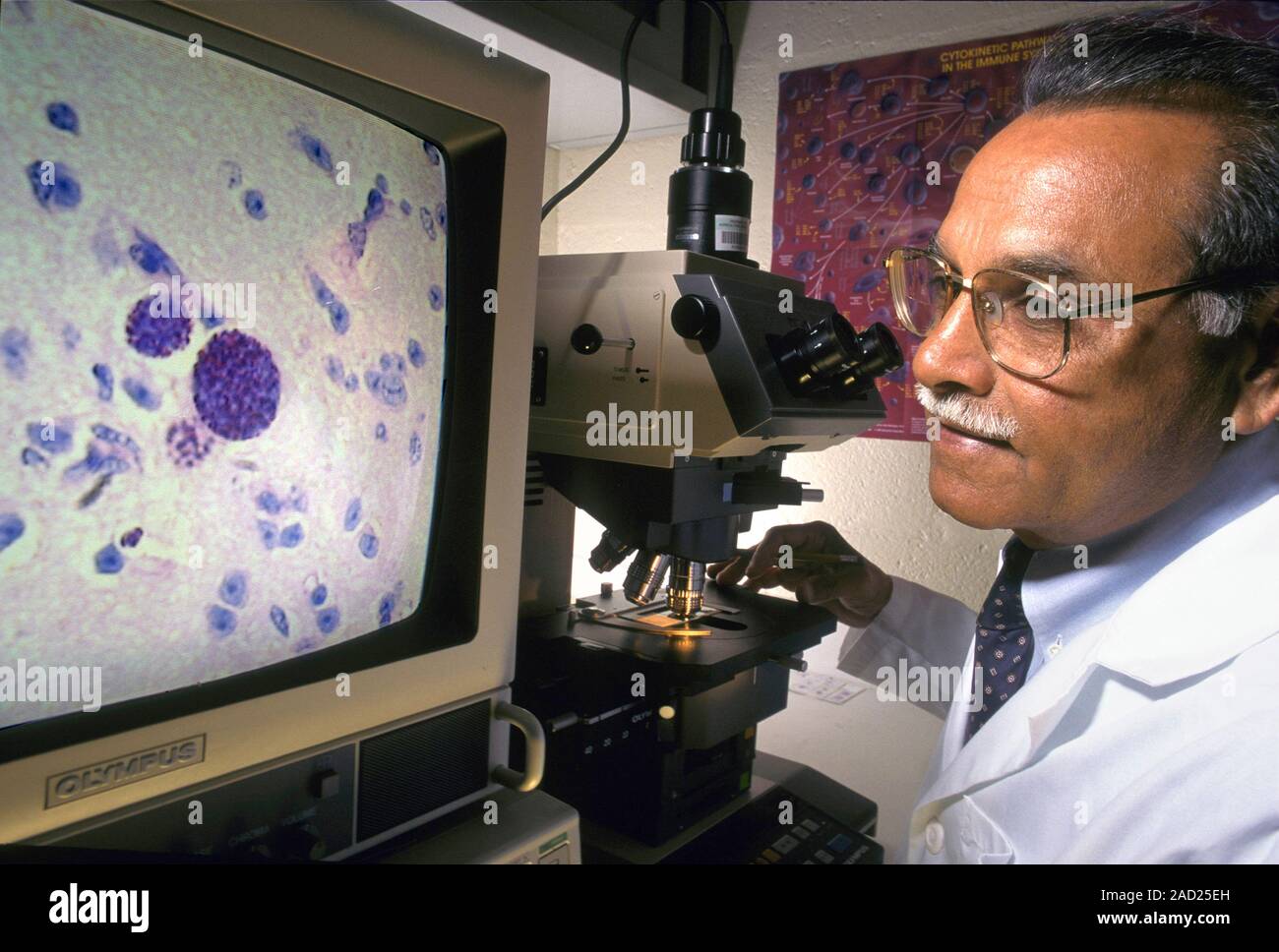 Pig parasite research. Microbiologist examining pig tissue samples for ...