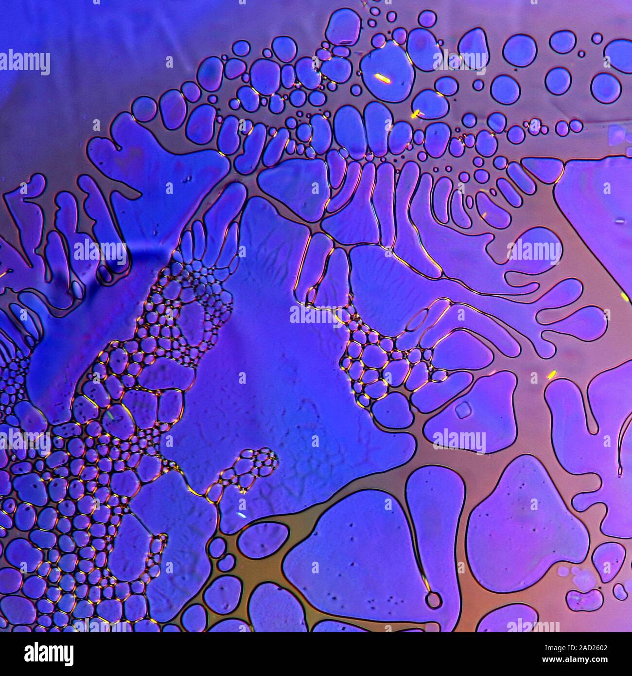 Vitamin C. Polarised light micrograph of a section through ascorbic ...