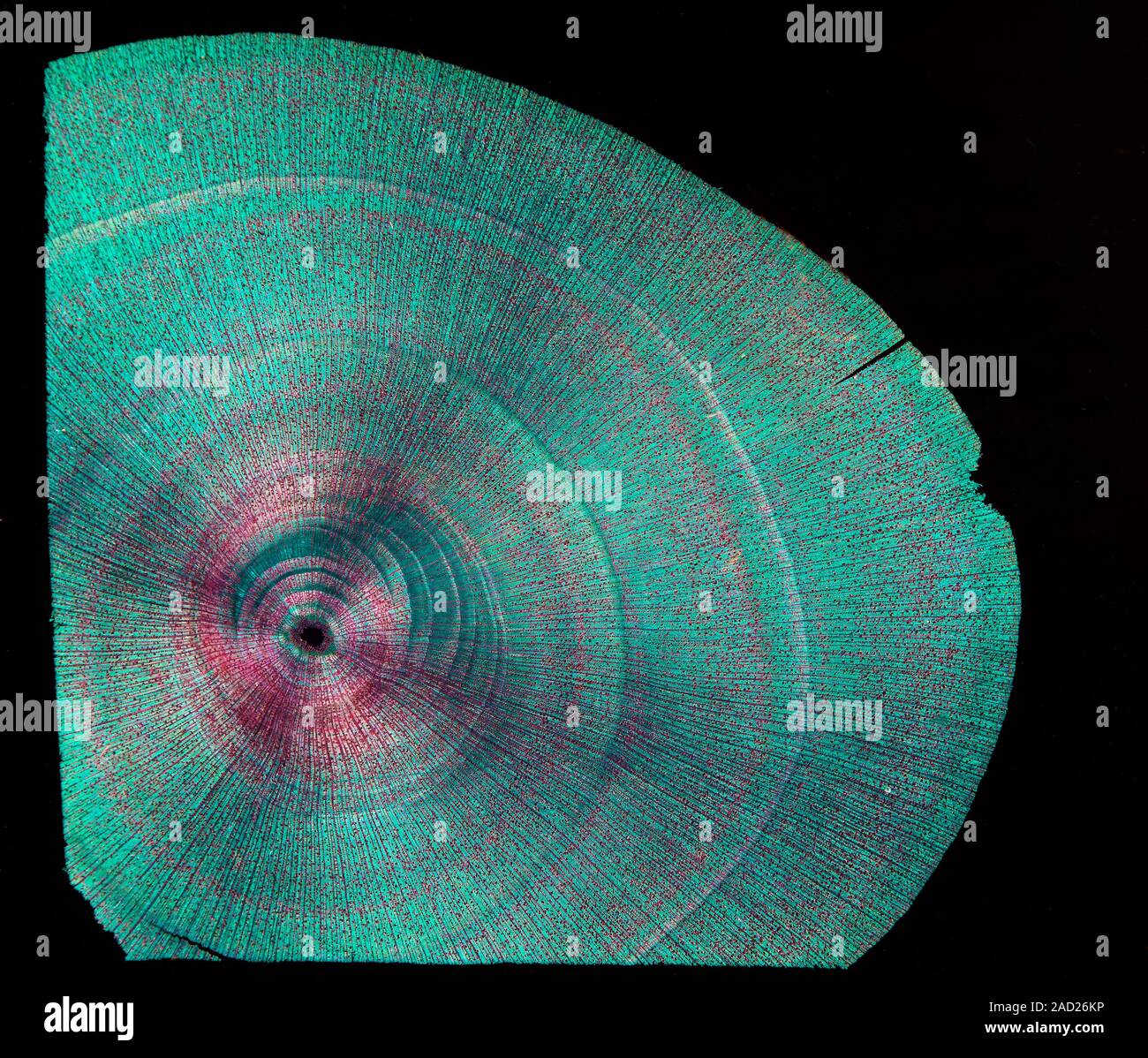 Botanical micrograph polarized light, transverse section of ...