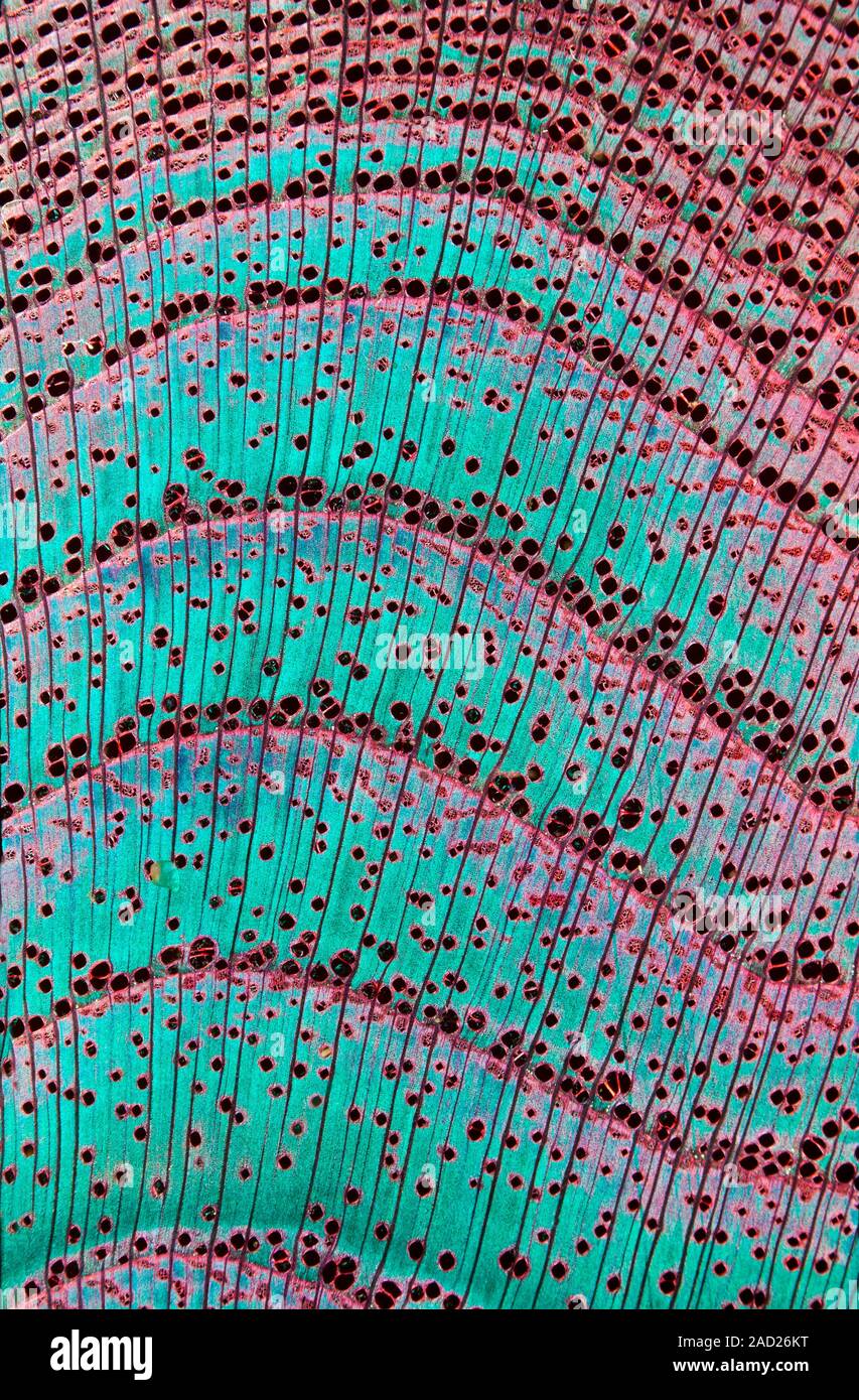 Botanical micrograph polarized light, transverse section of ...