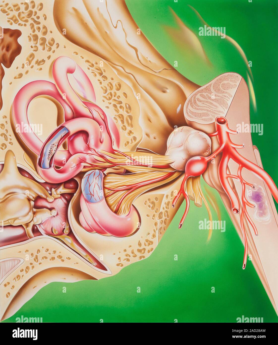 Illustration of the inner ear showing several causes of vertigo. One cause is labyrinthitis, the ...
