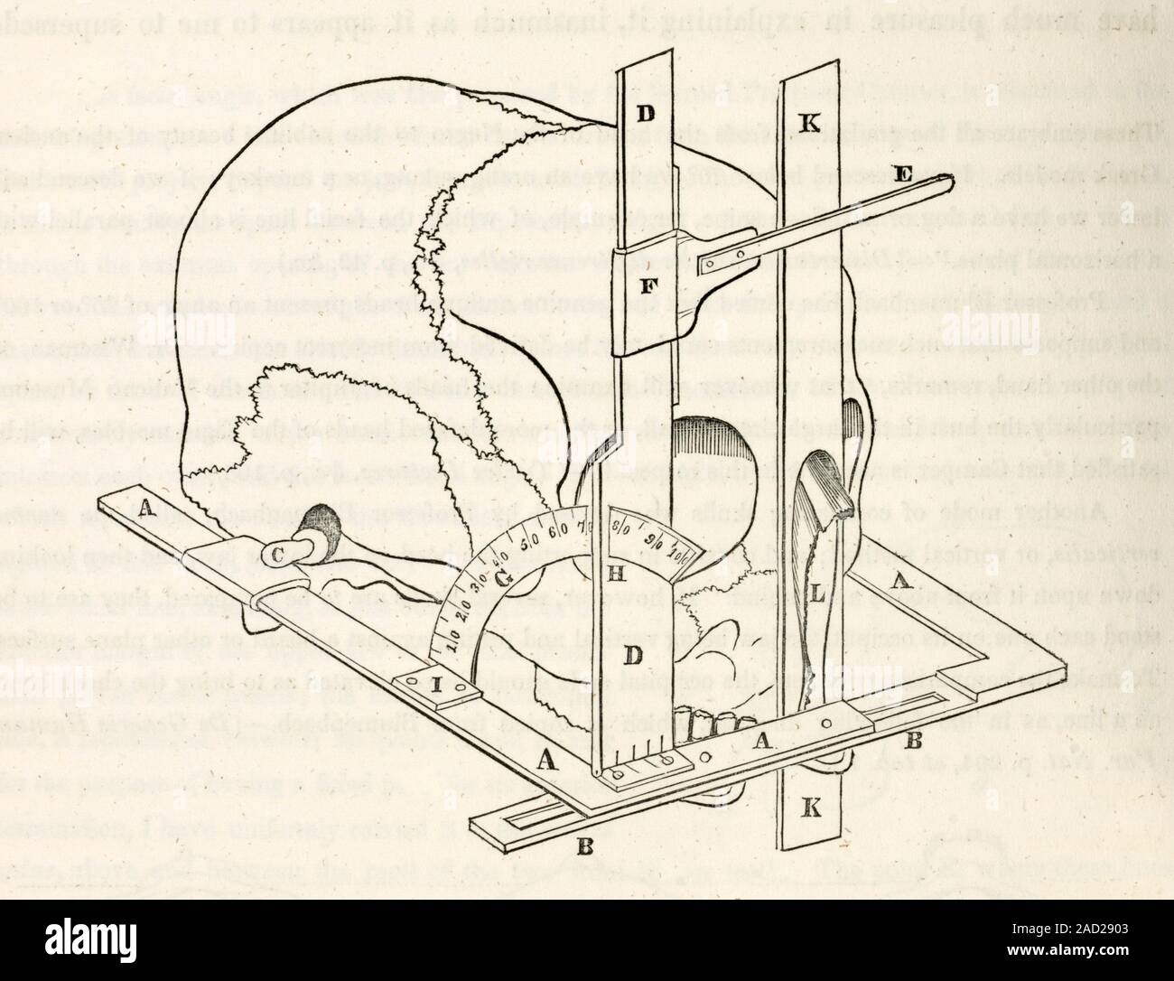 Facial goniometer, which measures dimensions of the skull. This ...