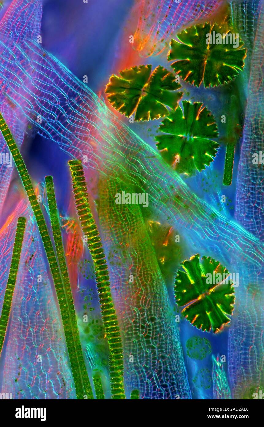Desmids on sphagnum moss. Darkfield illuminated polarised light ...