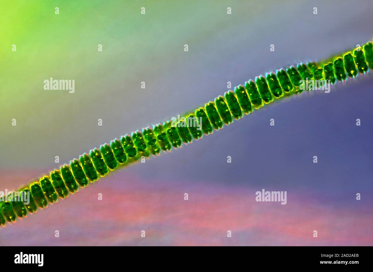 Desmids on sphagnum moss. Darkfield illuminated polarised light ...