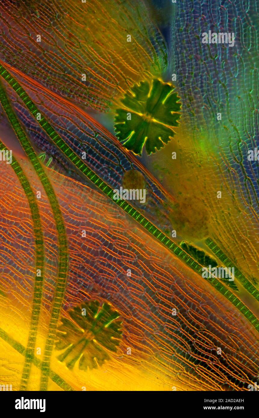 Desmids and sphagnum moss. Darkfield illuminated polarised light ...