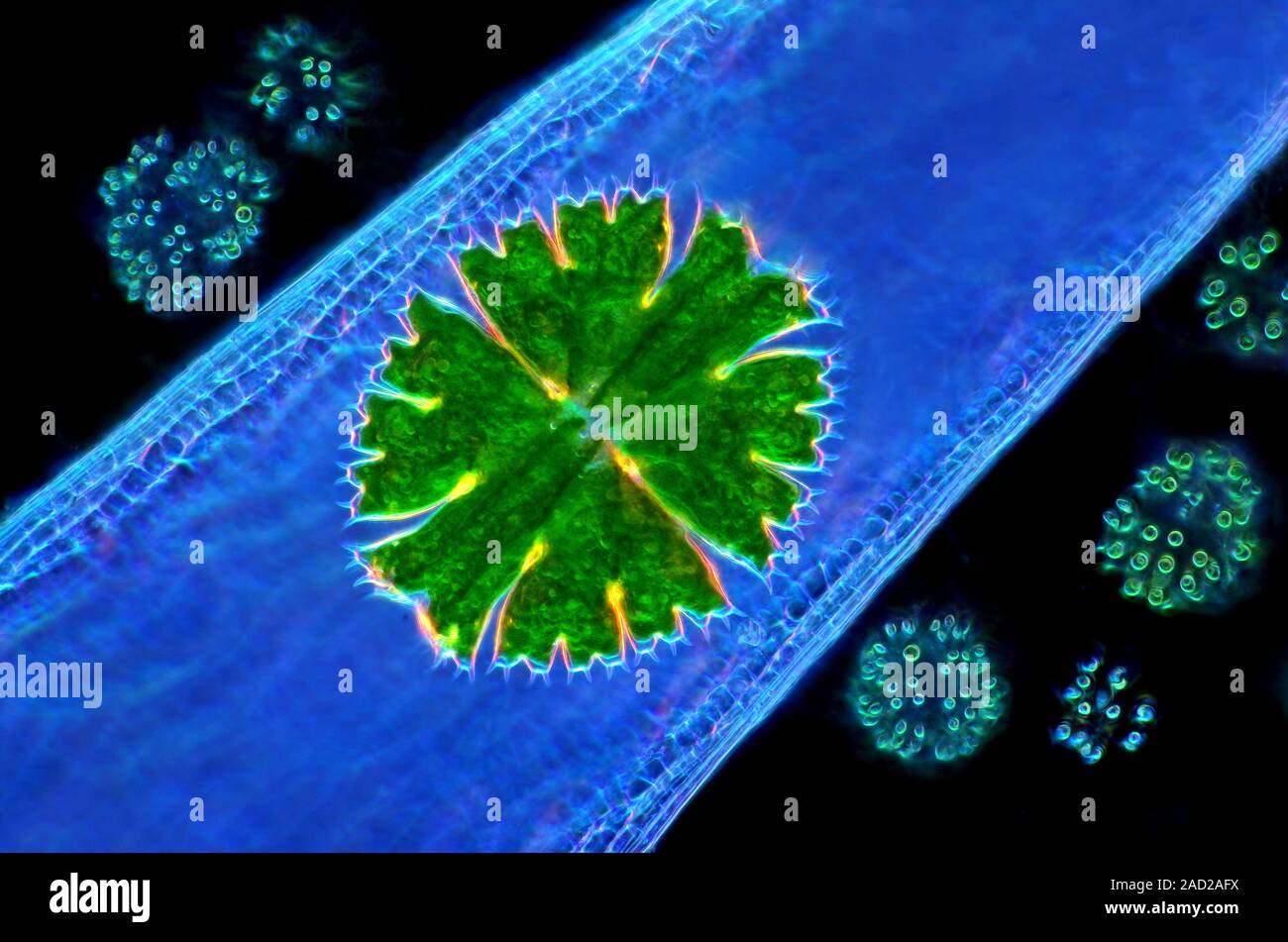 Desmid and Dictyosphaerium green algae. Darkfield illuminated polarised ...