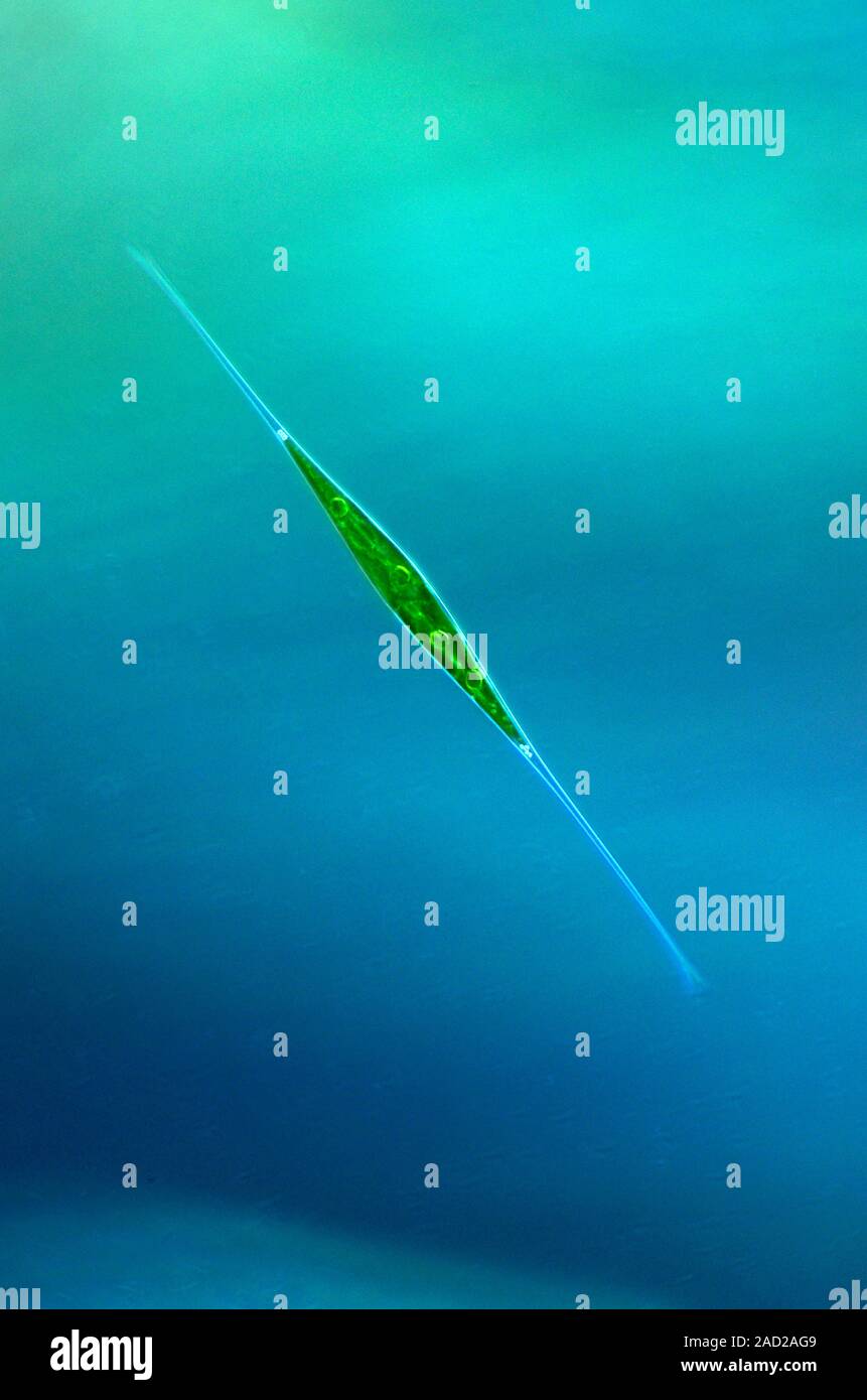 Closterium desmid. Darkfield illuminated polarised light micrograph of ...