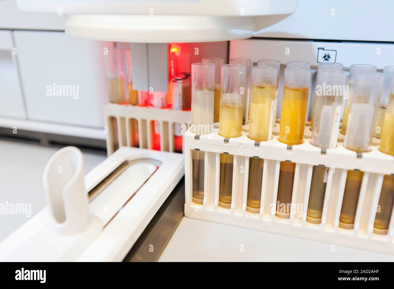 Urology laboratory. Urine samples being prepared for analysis in tubes ...